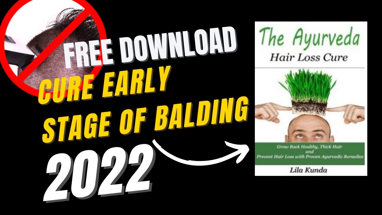 7 Stages Of Balding | Norwood Scale | Male Pattern Baldness Stages ...